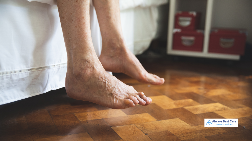 On Your Feet: Common Foot Problems For Seniors
