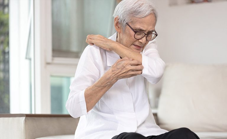 What Is Xeroderma? Causes, Symptoms & Treatment