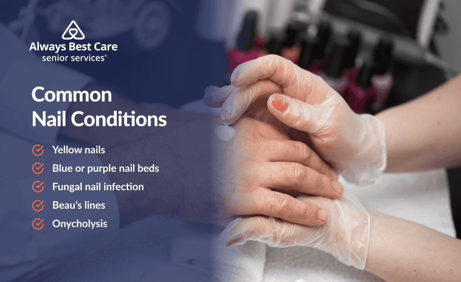 In-Home Nail Cutting For Seniors [+ How To Find Podiatrists]