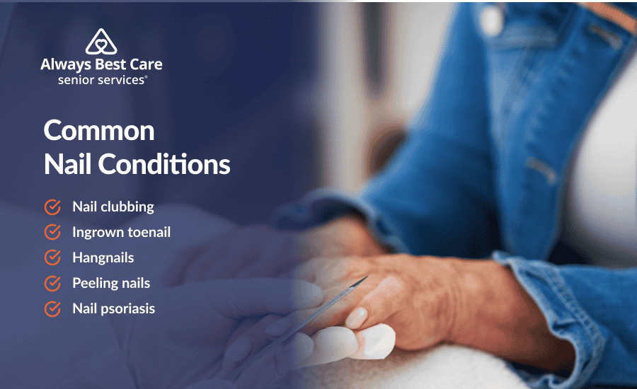 In-Home Nail Cutting For Seniors [+ How To Find Podiatrists]